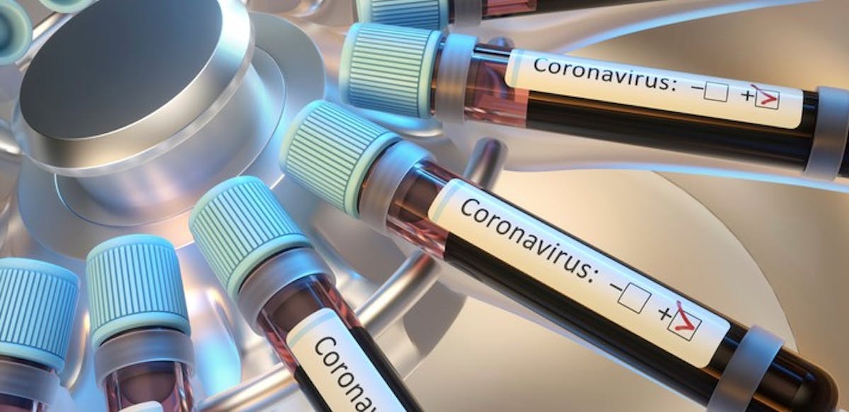 NY Times: Up To 90% Of People Who Test Positive For COVID-19 No Longer ...