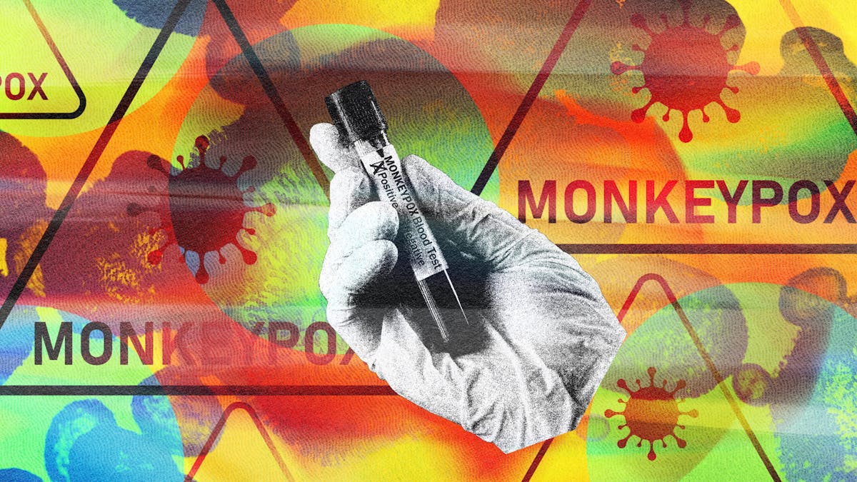 Here’s Everything You Need To Know About The Monkeypox Outbreak | The ...